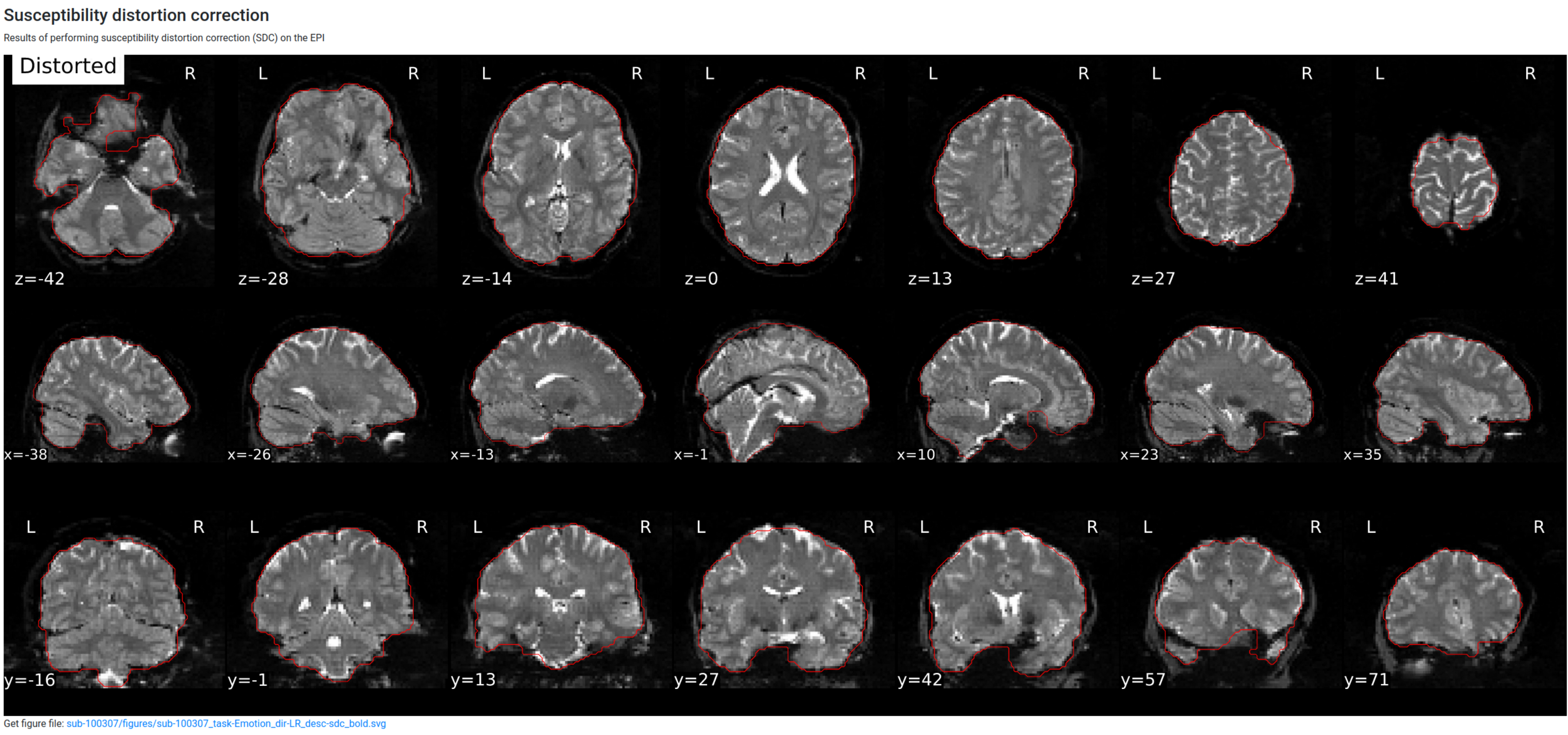 Fieldmaps causing fMRIprep to get crash · Issue #2947 · nipreps/fmriprep · GitHub