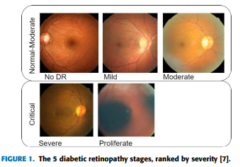 GitHub - MOLOZISE/med_hackathon_gan_dataaug: FastGAN + MaxViT, ViTGAN