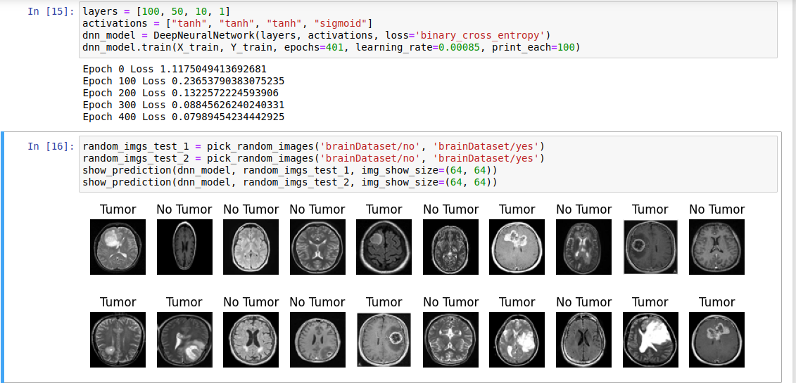 Github Dhiahan Brain Tumor Mri Classification A Deep Neural Network That Classifies Mri