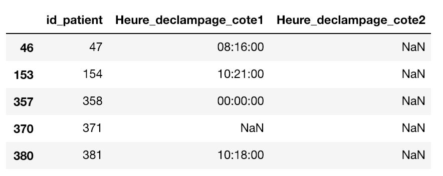 Encoding des heures evenements (clampage, declampage) · Issue #56 · dataforgoodfr/batch_5 ...