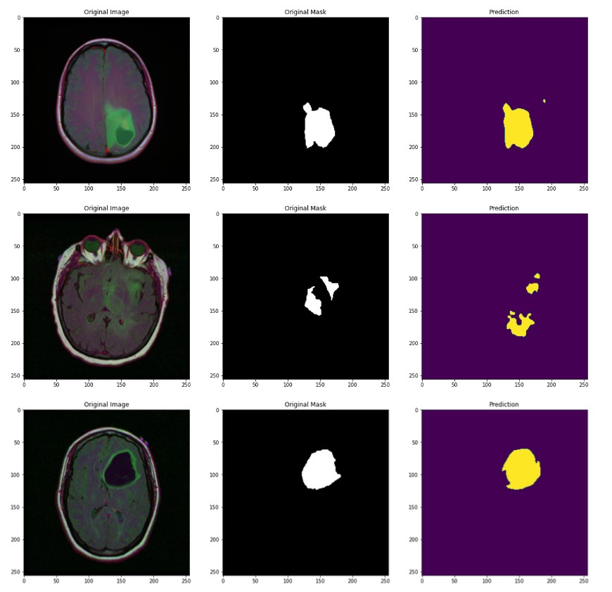GitHub - PromitHal/BRAIN_MRI_Image_Segmentation GitHub - PromitHal/BRAIN_MRI_Image_Segmentation