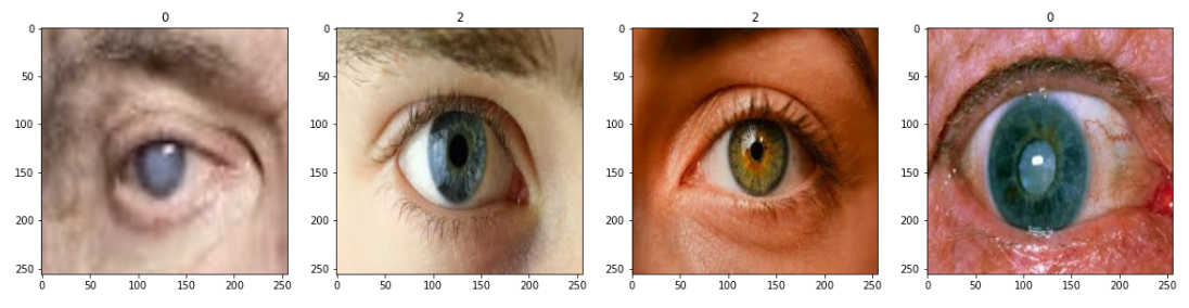 GitHub - brittmorin/classifying_eye_conditions: CNN classifier project