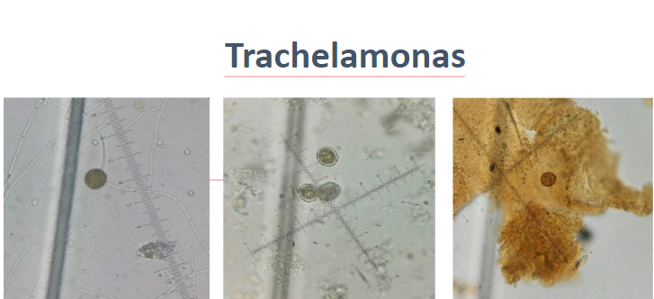 GitHub - im-data-explorer/Object_Detection_Fitoplankton: проект построения нейронной сети ...