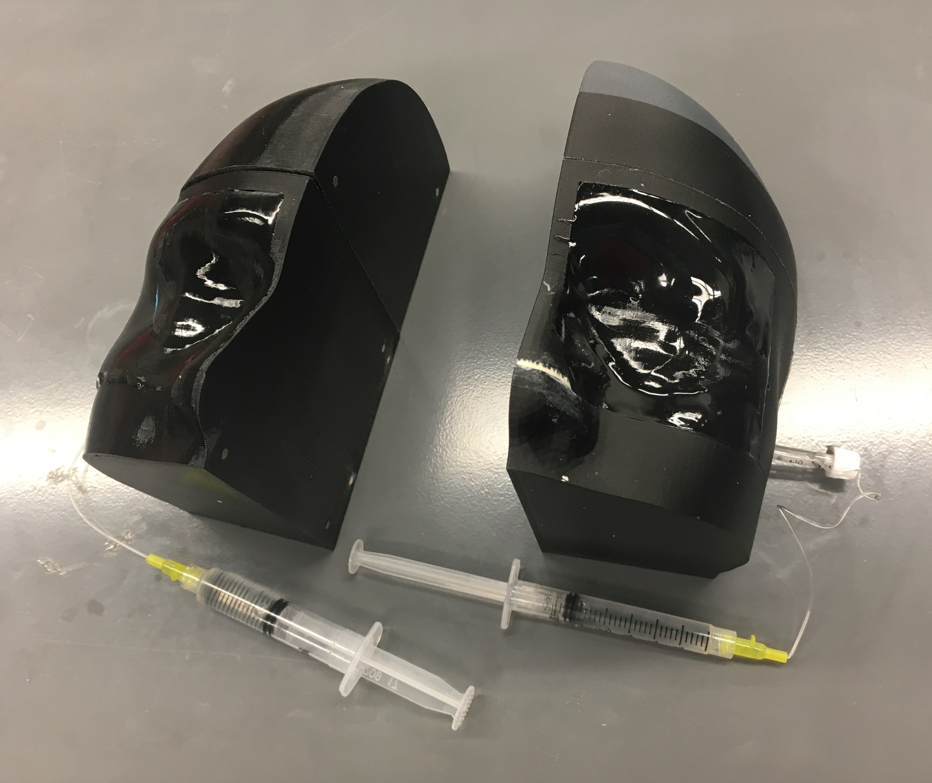 GitHub - tgh-apil/Optic-Nerve-Sheath-Phantom: A transorbital ...