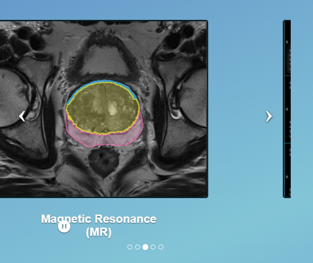 Replace Image examples tab with carousel · Issue #998 · ImagingDataCommons/IDC-WebApp · GitHub