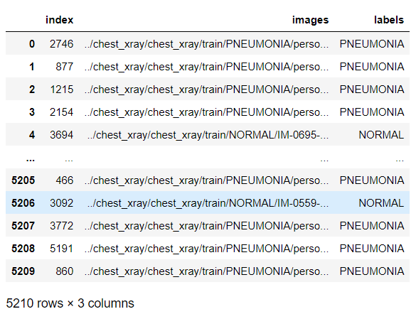 Github Abhijitgokhale Pneumonia Detection Chest Xray Images Using Cnn Keras Tensorflow An End