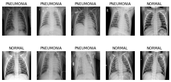 GitHub - AbhijitGokhale/Pneumonia-Detection-Chest-XRAY-Images-using-CNN ...