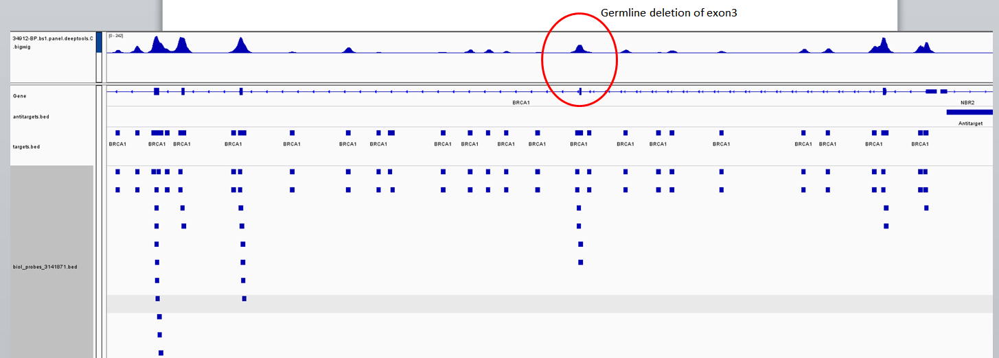 Selecting reference samples for germline hybrid capture sequencing data · Issue #422 · etal ...