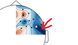 Spurious values when using plot_topomap · Issue #5315 · mne-tools/mne-python · GitHub