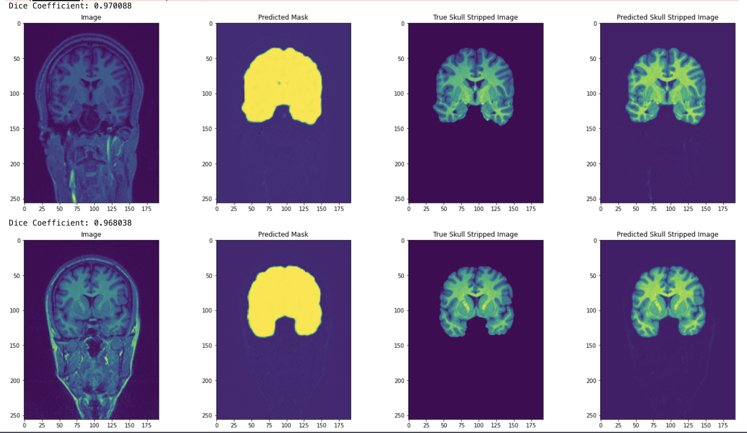 GitHub - maloyk-ai/Brain-Skull-Segmentation: Skull Stripping of MRI images using UNet
