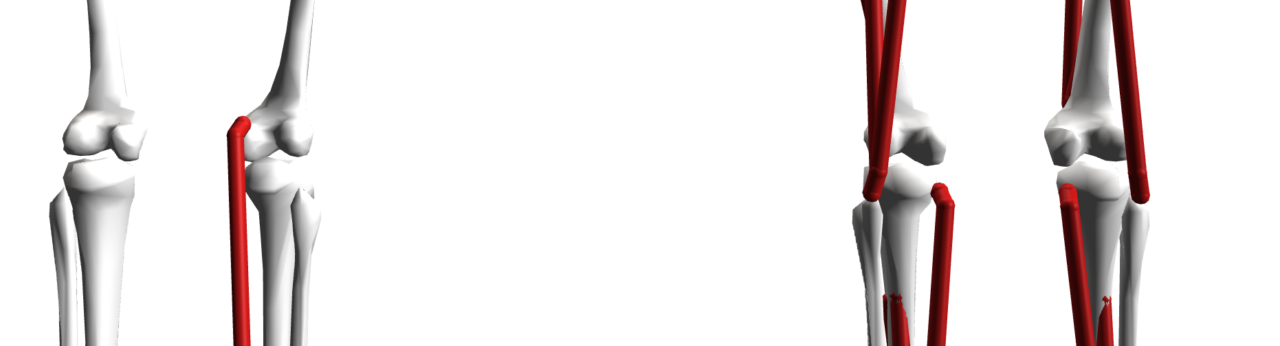 Gait10dof18musc Gastroc path causes knee extension moment arm · Issue ...