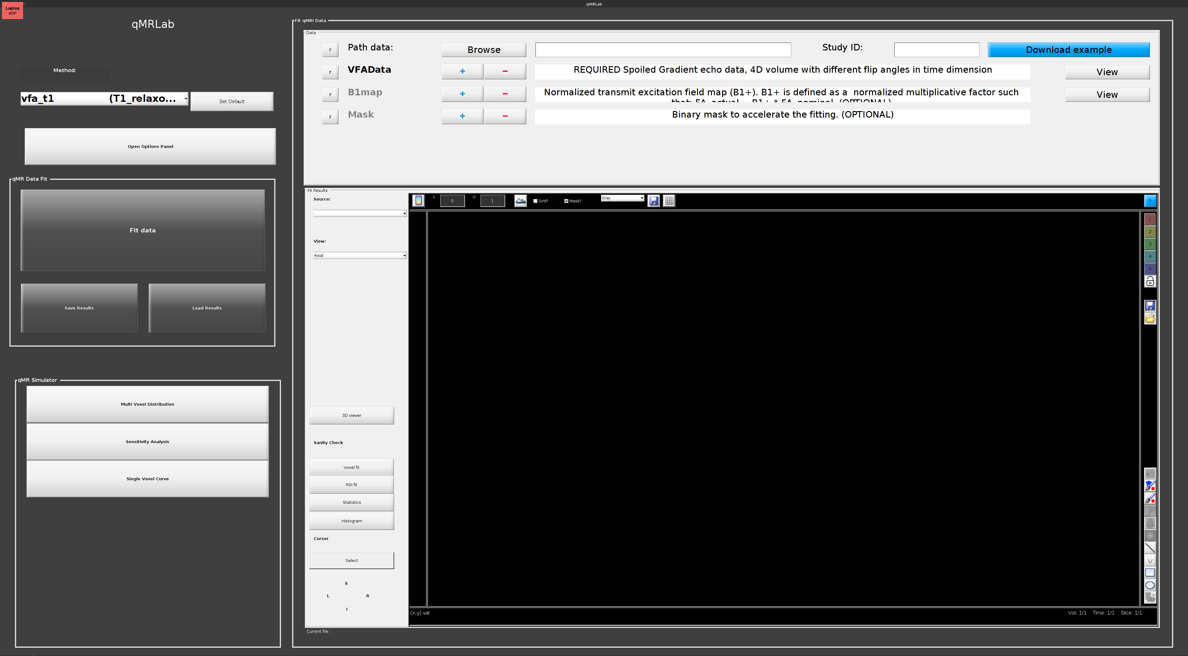 Unrecognised Function or Variable ‘vfa_t1’ · Issue #449 · qMRLab/qMRLab · GitHub