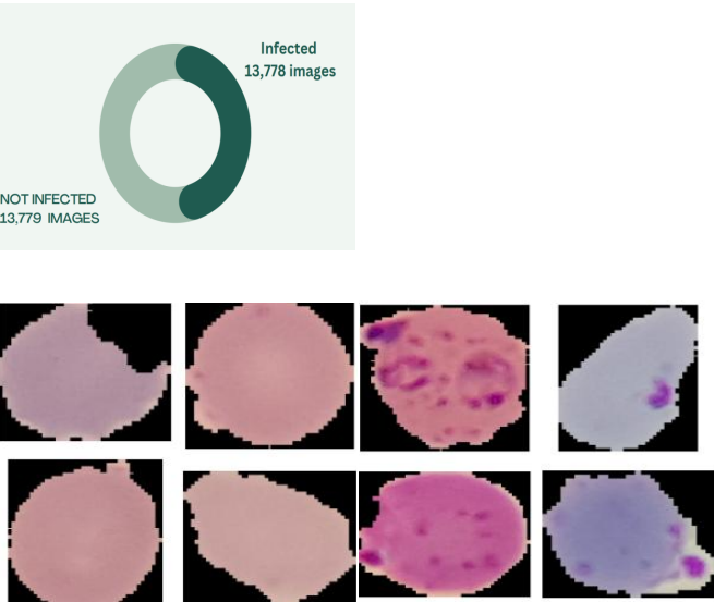 GitHub - nikhil-188/Malaria_Classification_usingDL: In this project, I implemented algorithms ...