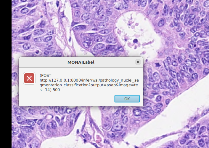 MONAI Model Zoo Discussion - pathology_nuclei_segmentation ...