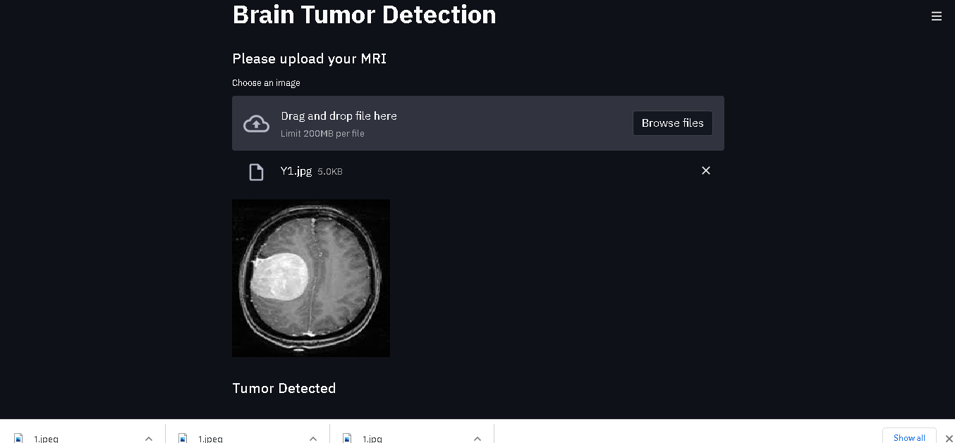 GitHub - LaxmanSingh01/Brain-Tumor-Detection