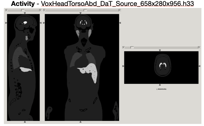 GitHub - BenAuer2021/Mesh-based-Human-Phantom-for-Simulation