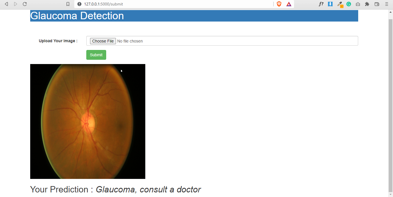 GitHub - SohaHussain/Glaucoma-Detection: An end-to-end deep learning ...