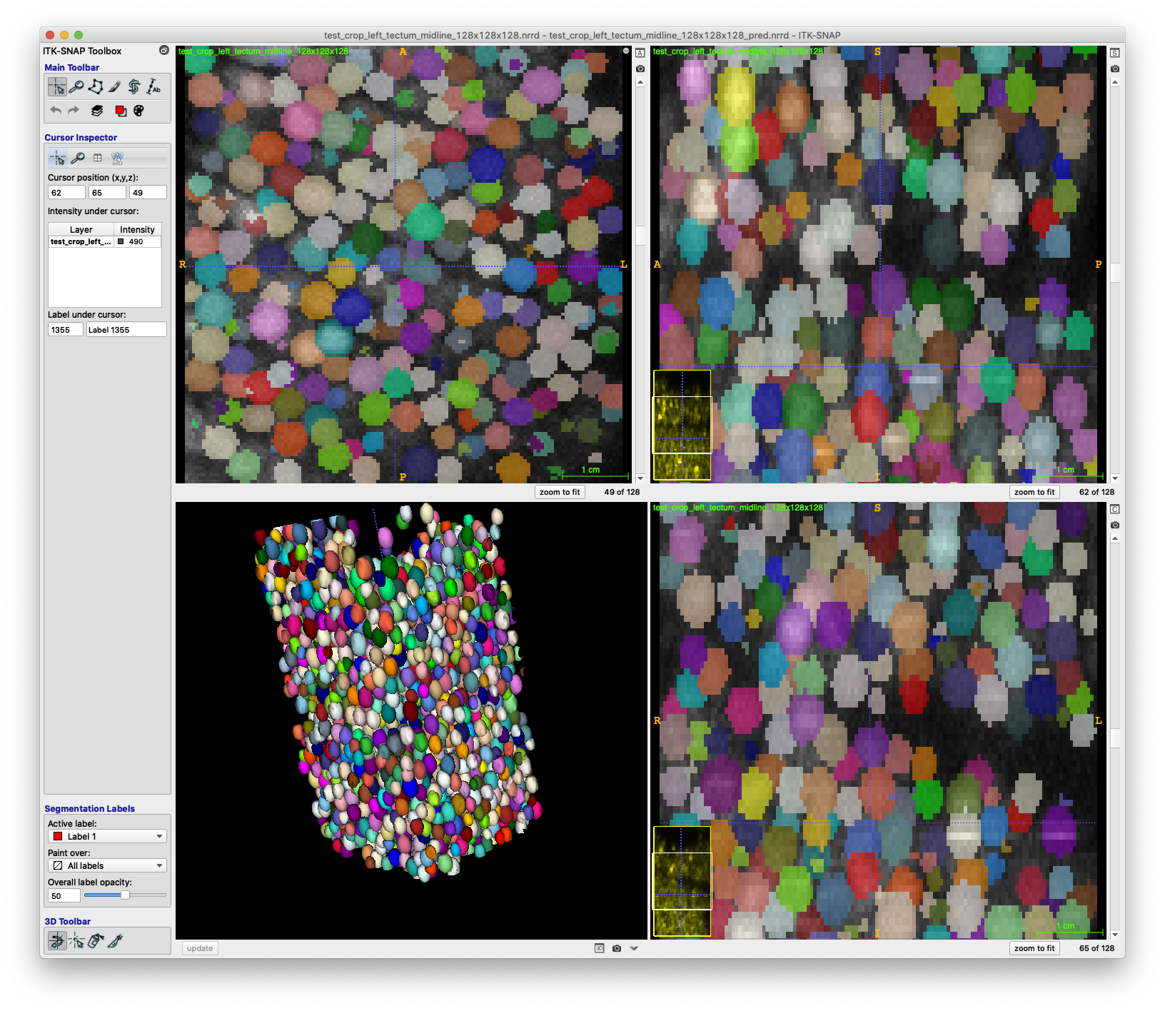 Obtaining dist and prob maps directly · Issue #36 · stardist/stardist · GitHub