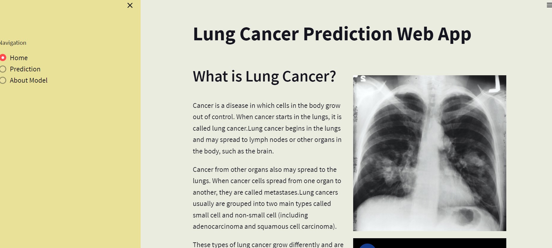 GitHub - Nishan8912/Lung_Cancer_Detection