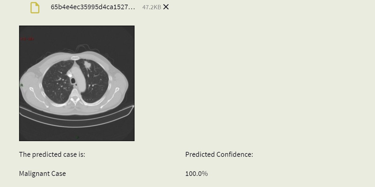 GitHub - Nishan8912/Lung_Cancer_Detection