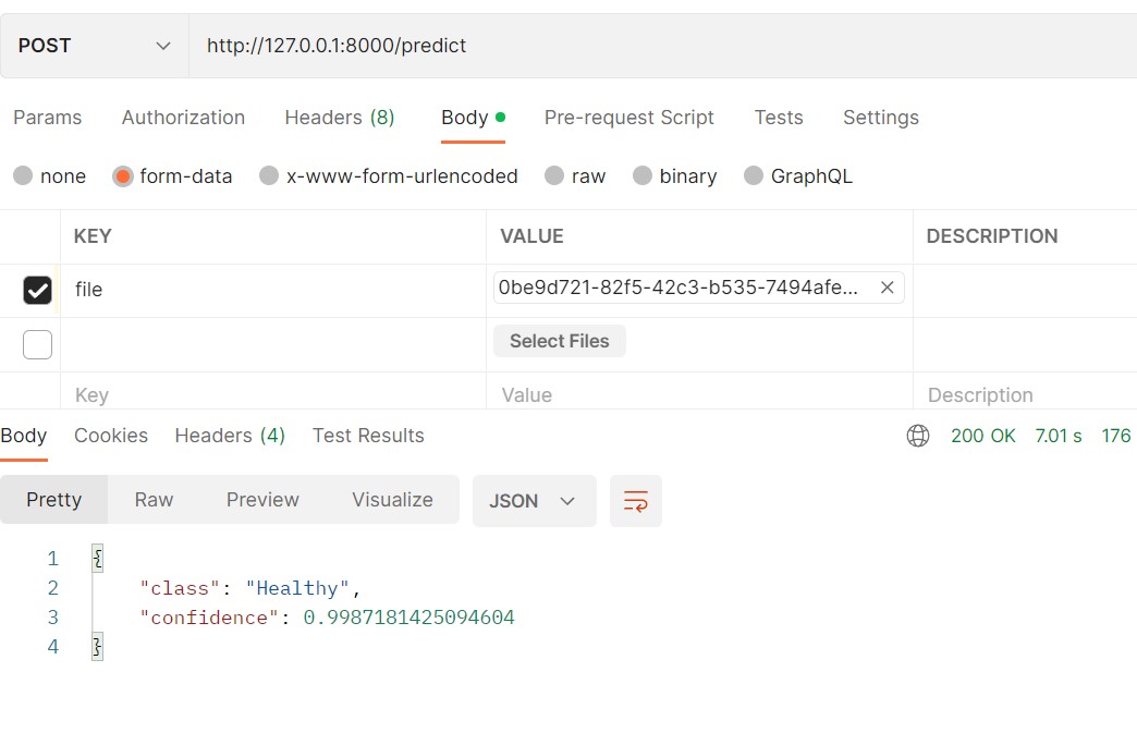 GitHub - Nishan8912/potato-diesese-prediction
