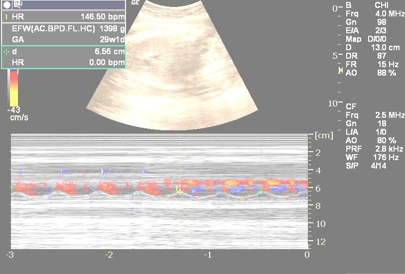 Not Getting Expected Result From Dicom File · Issue 1429 · Pydicom Pydicom · Github
