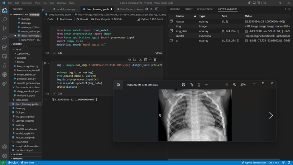 GitHub - Rochan-Raj/CovidPneumonia