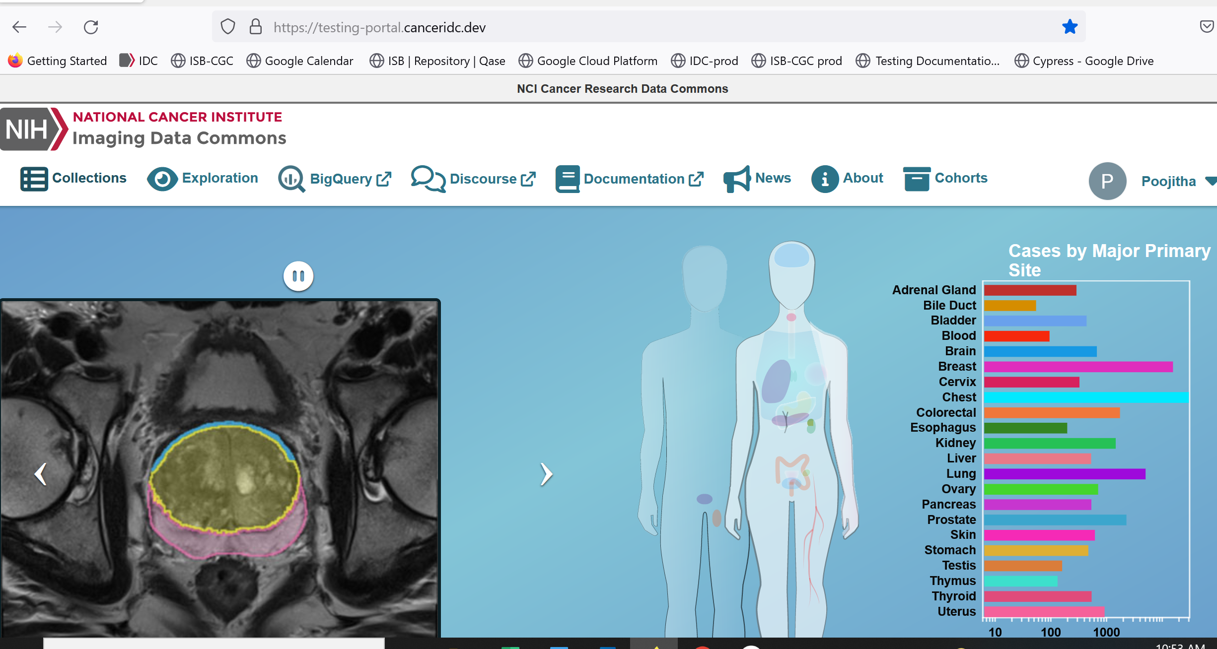 Replace Image examples tab with carousel · Issue #998 · ImagingDataCommons/IDC-WebApp · GitHub