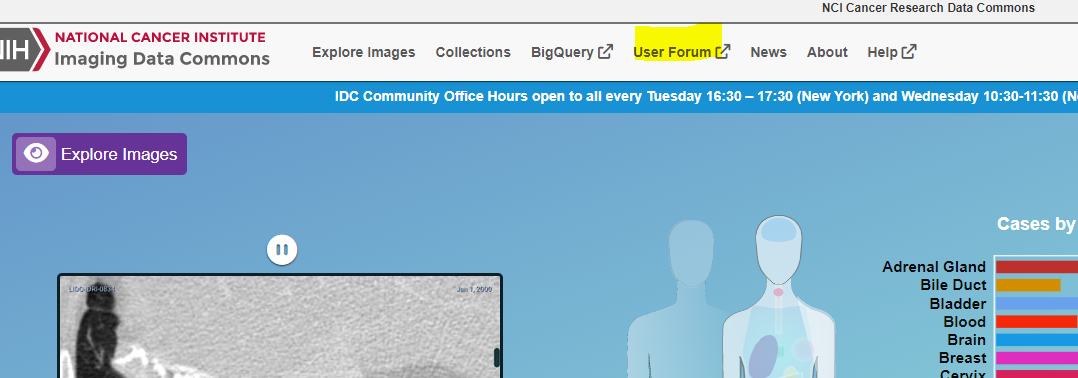 Rename "Discourse" to "User forum" on the front page · Issue #1045 · ImagingDataCommons/IDC ...
