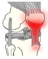 GitHub - jermason95/3D-Bioprinted-Tissues