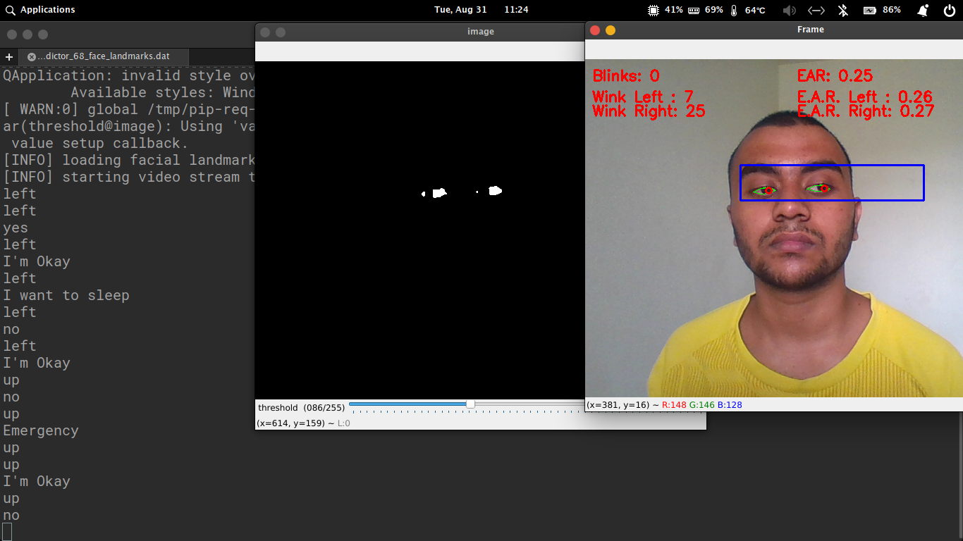 GitHub - praajnabaragur/Blink-To-Speak-Application
