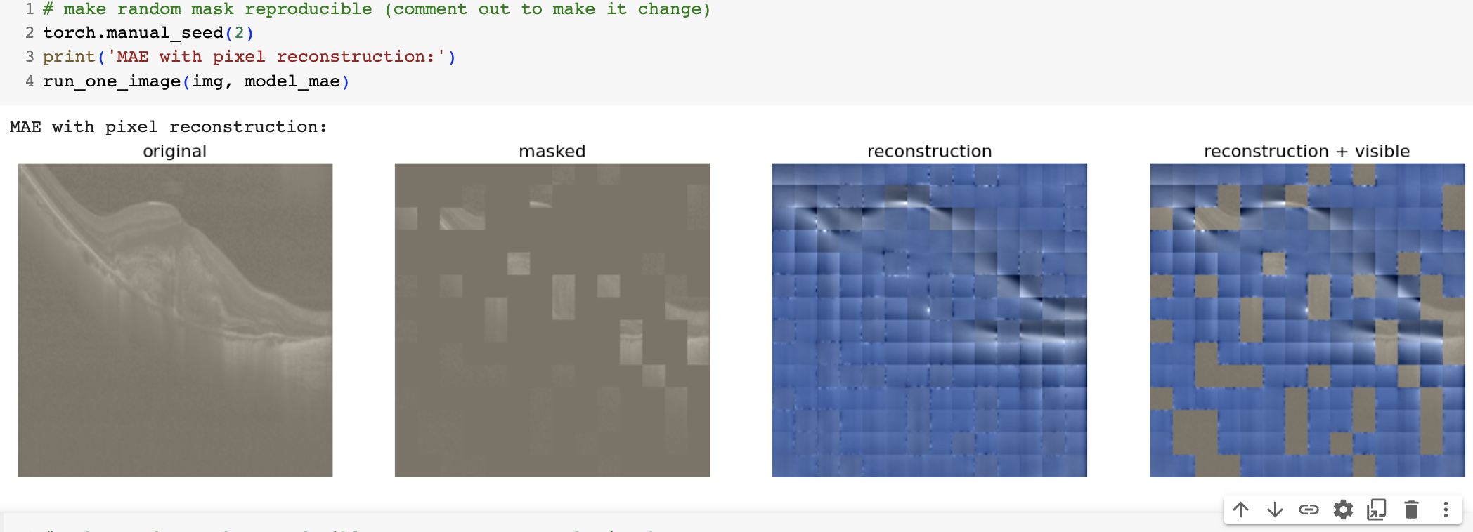 Unable to get the model · Issue #9 · rmaphoh/RETFound_MAE · GitHub