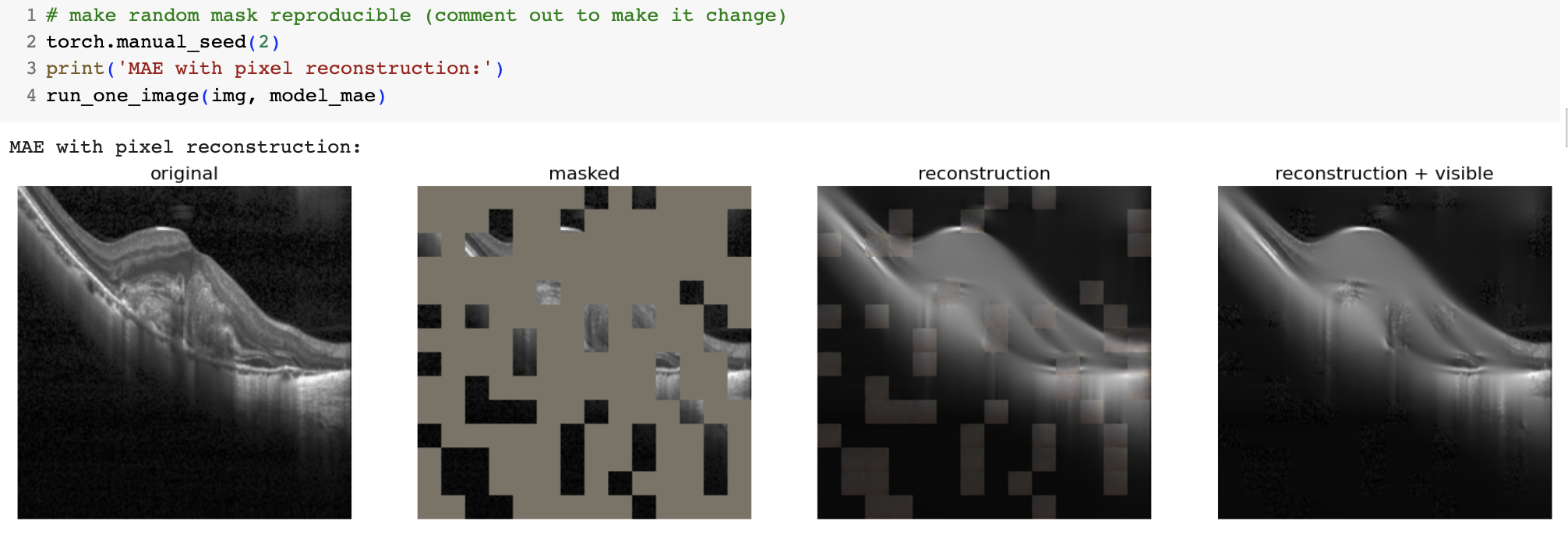 Unable to get the model · Issue #9 · rmaphoh/RETFound_MAE · GitHub