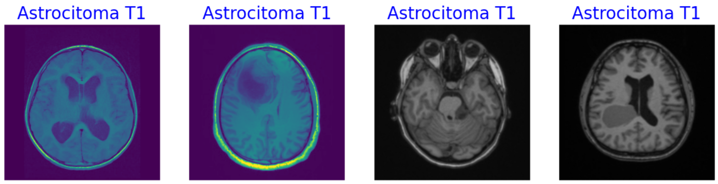 GitHub - bassantmedhat/Brain_Tumor_Classification_Using-Deep-Learning-