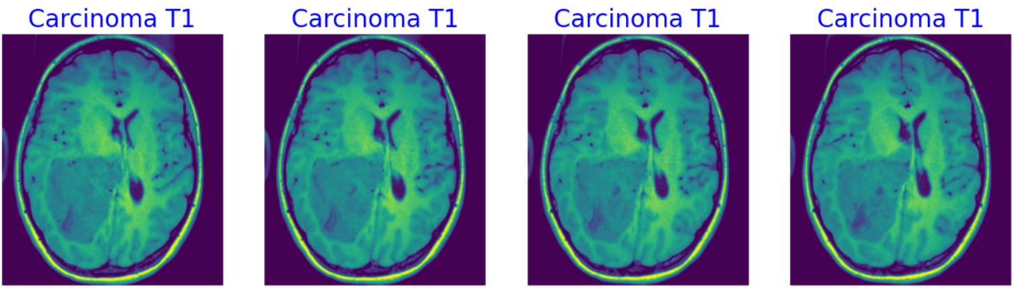 GitHub - bassantmedhat/Brain_Tumor_Classification_Using-Deep-Learning-