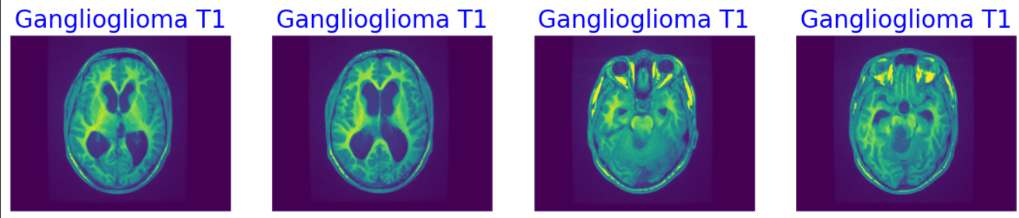 GitHub - bassantmedhat/Brain_Tumor_Classification_Using-Deep-Learning-