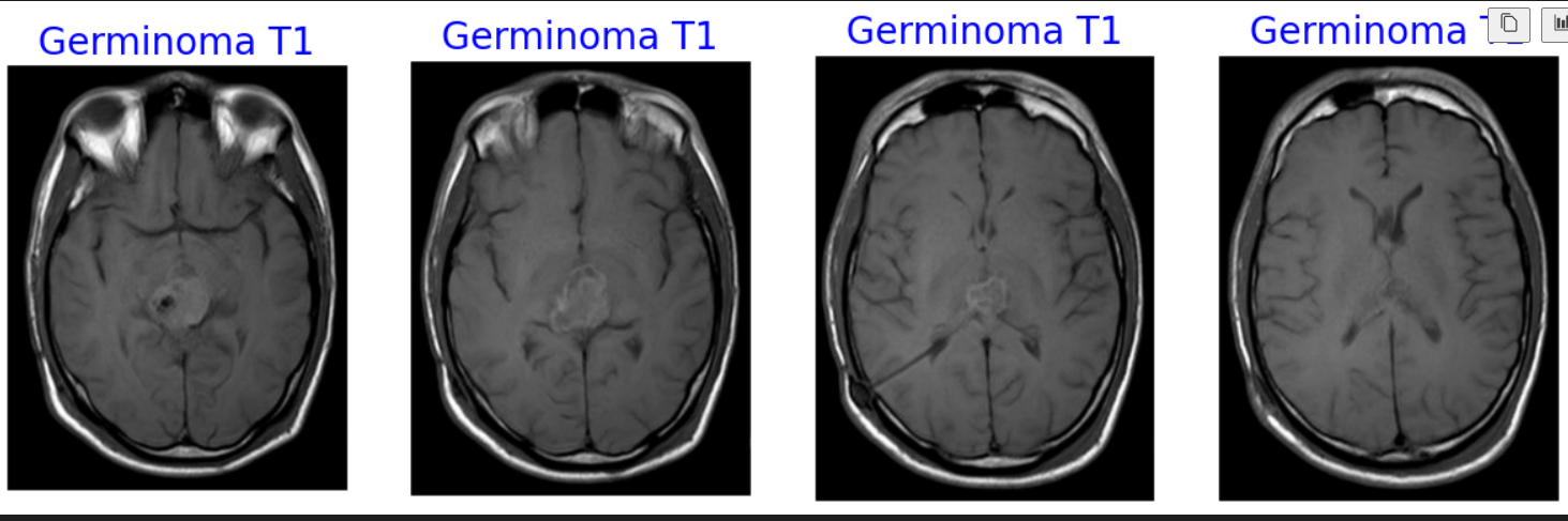 GitHub - bassantmedhat/Brain_Tumor_Classification_Using-Deep-Learning-