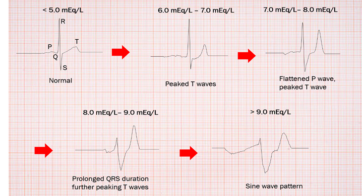 GitHub - MbetterLife-dsp/Deep-Learning-based-Serum-Potassium-Level ...