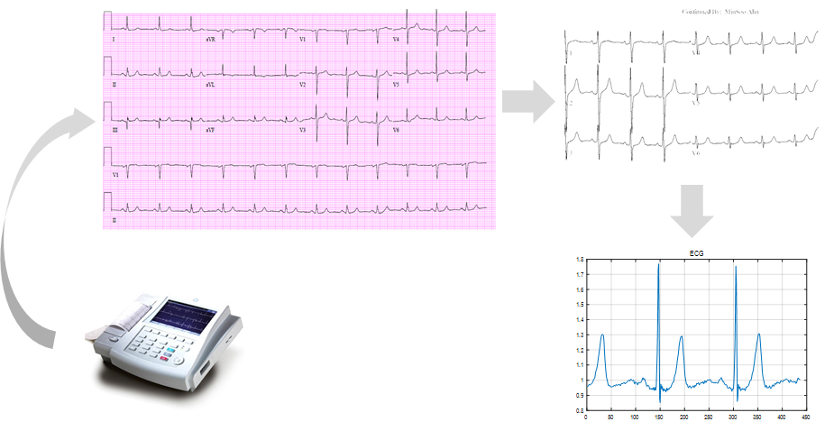GitHub - MbetterLife-dsp/Deep-Learning-based-Serum-Potassium-Level ...