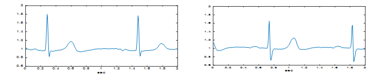 GitHub - MbetterLife-dsp/Deep-Learning-based-Serum-Potassium-Level ...