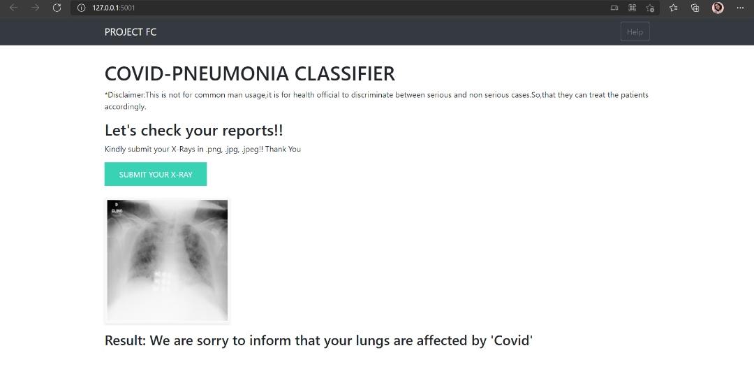 GitHub - Ayshwarya02/Covid-and-Pneumonia-detection