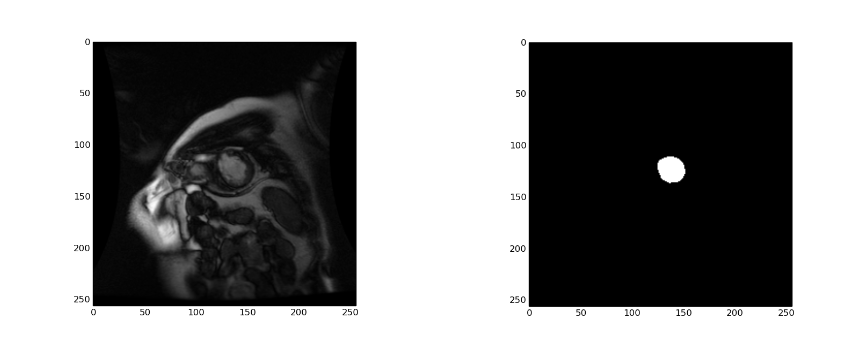 GitHub - KevKibe/Image-Segmentation-using-TensorFlow: Perform semantic segmentation to classify ...