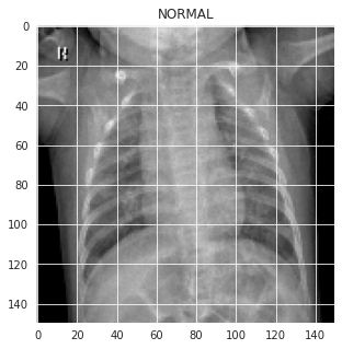 GitHub - Sushma-Rani2023/Pneumonia-classification