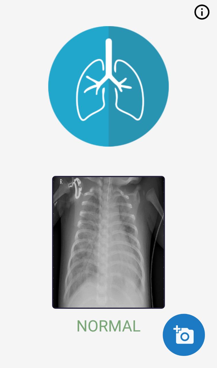 GitHub - Sushma-Rani2023/Pneumonia-classification