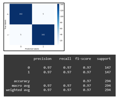GitHub - Sadeepi/Pulmonary_Tuberculosis-_desease-detection