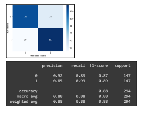 GitHub - Sadeepi/Pulmonary_Tuberculosis-_desease-detection