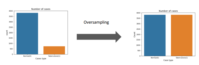 GitHub - Sadeepi/Pulmonary_Tuberculosis-_desease-detection