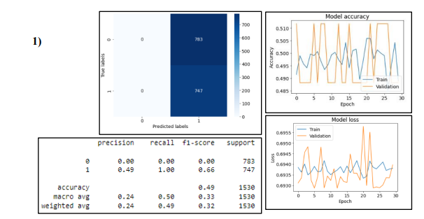 GitHub - Sadeepi/Pulmonary_Tuberculosis-_desease-detection