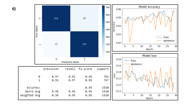 GitHub - Sadeepi/Pulmonary_Tuberculosis-_desease-detection