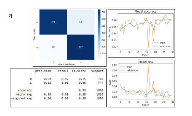 GitHub - Sadeepi/Pulmonary_Tuberculosis-_desease-detection